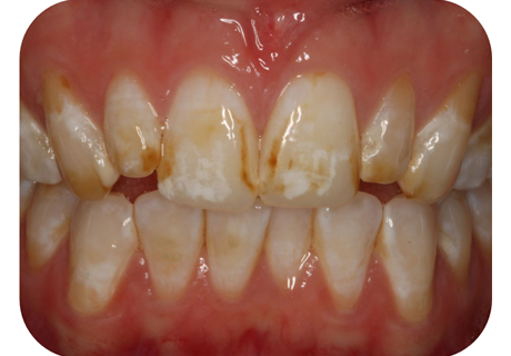 Dentisteria Estética